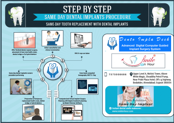 Same Day Dental Implants Cost Smile in Hour Dentist Dental Clinic India